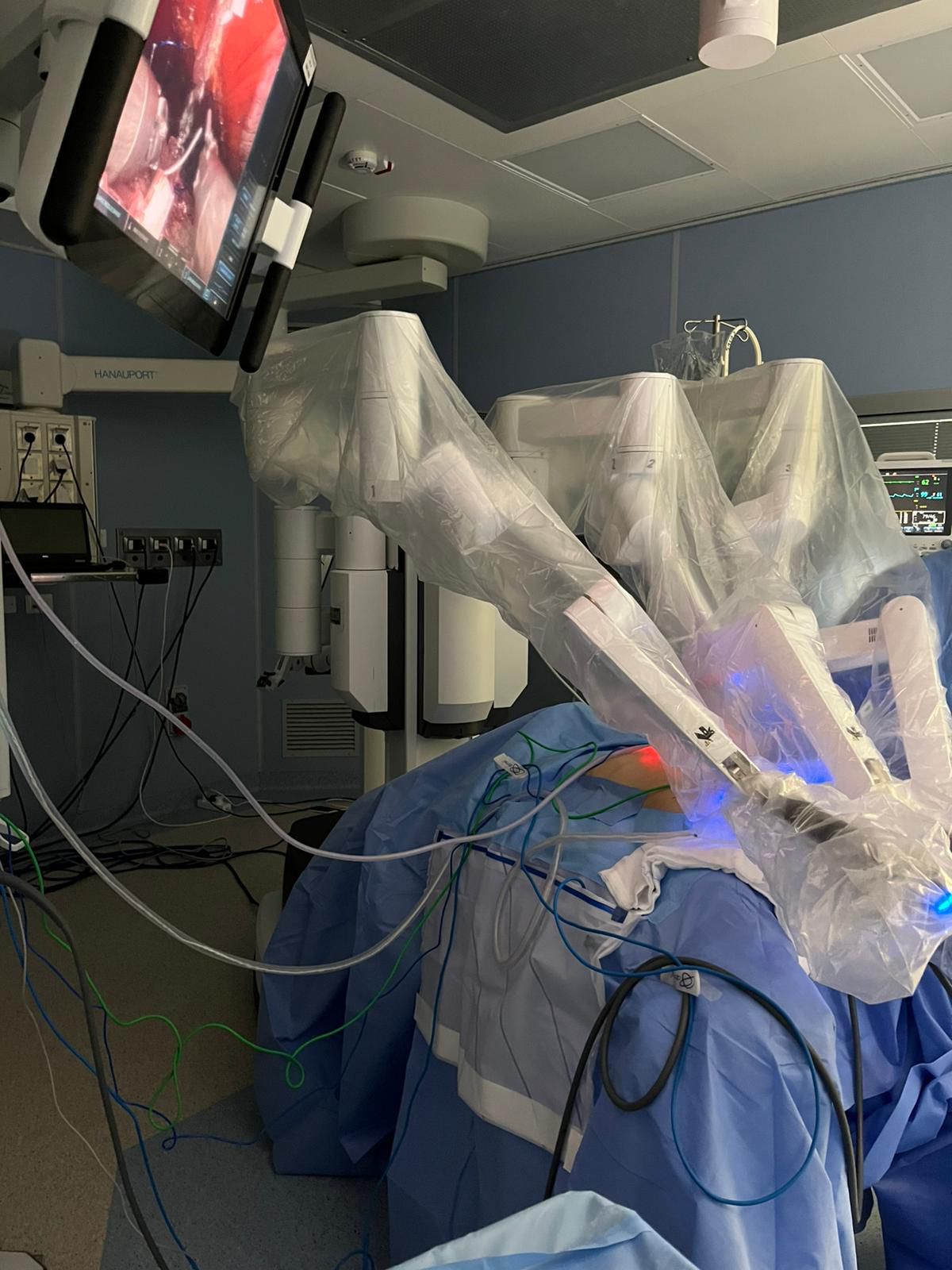 Tecnica miSAR® - Gabriele Manetti